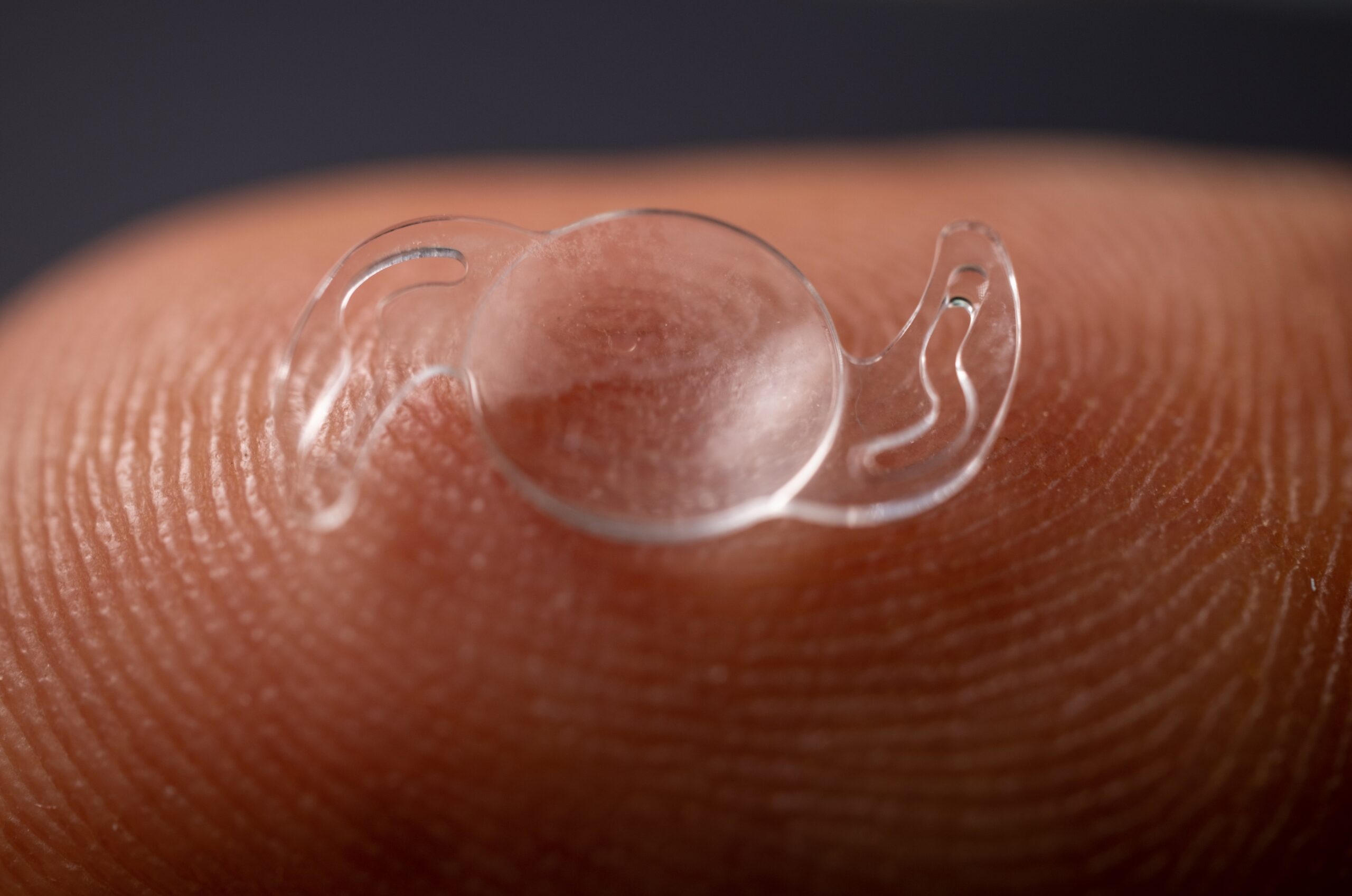 Phakic Intraocular Lenses Verisyse IOL | Vision Correction Albany